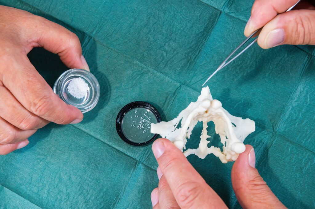 StreseDent Hannover: Knochenaufbau nach Maß